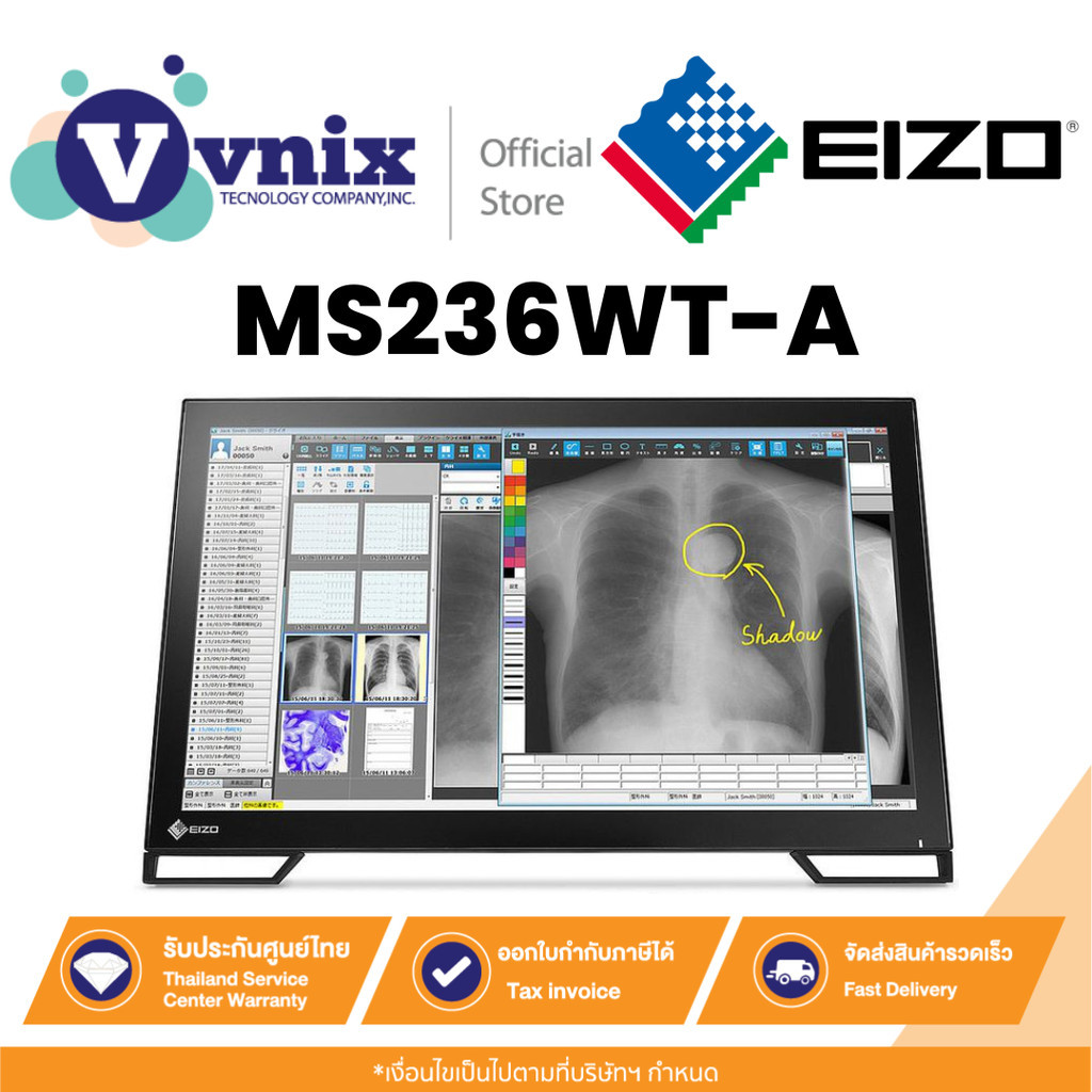 EIZO MS236WT-A RadiForce จอคอมพิวเตอร์ 23.0" Touch Panel Color LCD ...