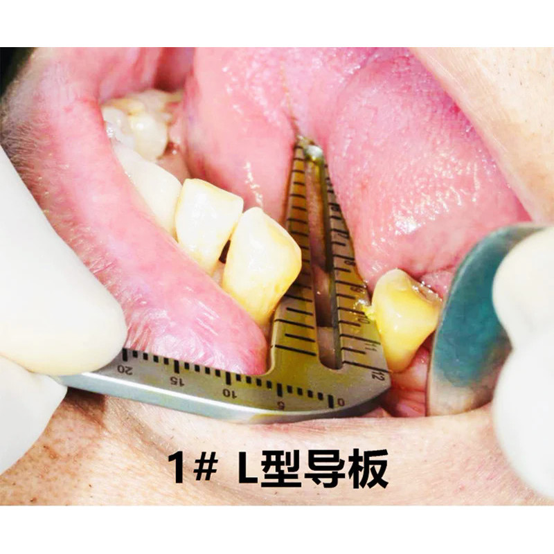 Dental Implant Guide Set Oral Planting Locator Positioning Guide ...