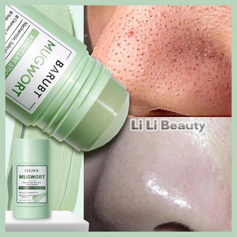 Acne clay Mask stick 40g Mugwort Acne Mud Mask Niacinamide Bright Oil ...