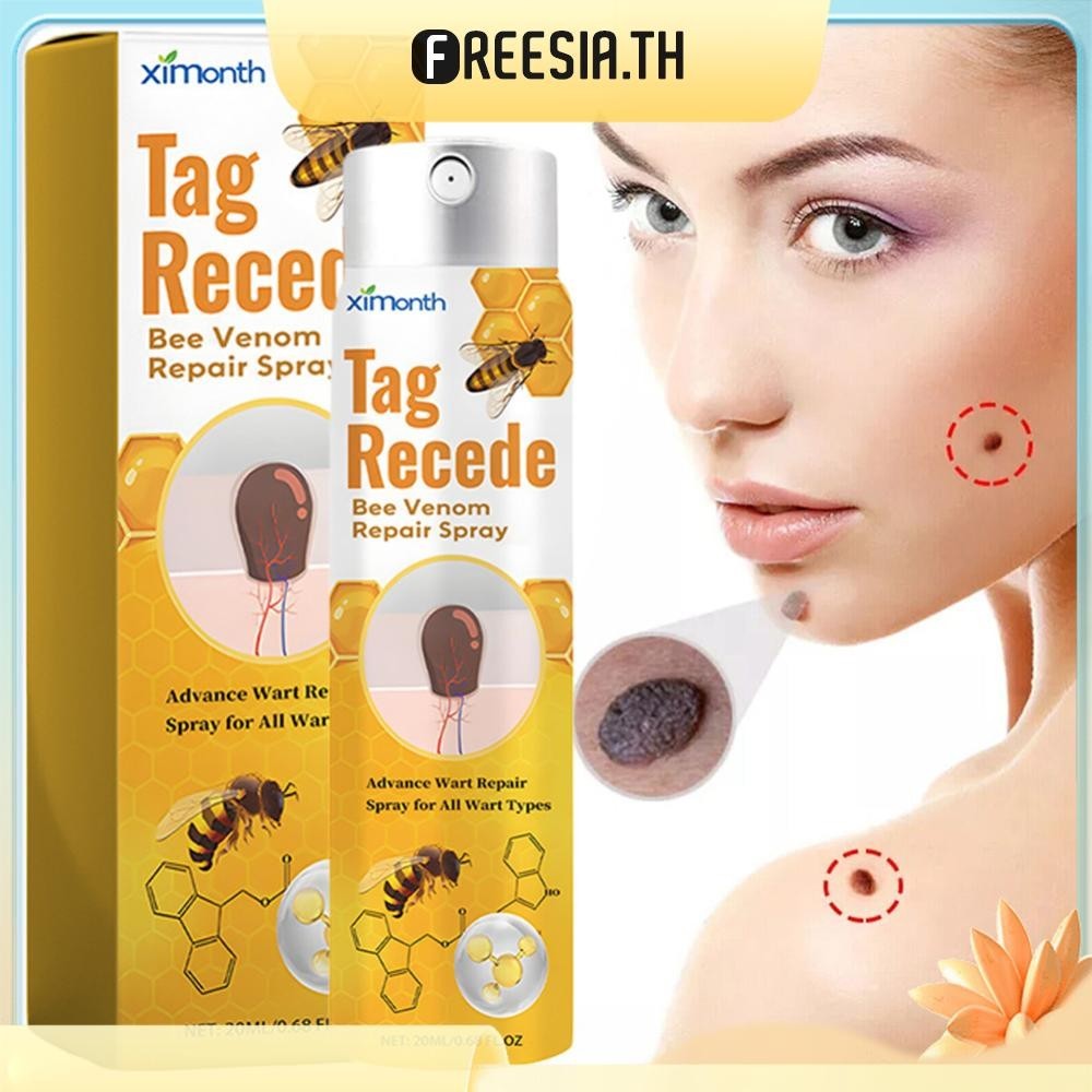 Bee Venom Treatment Spray 20ml Wart Skin Tags Removal Treatment Spray ...