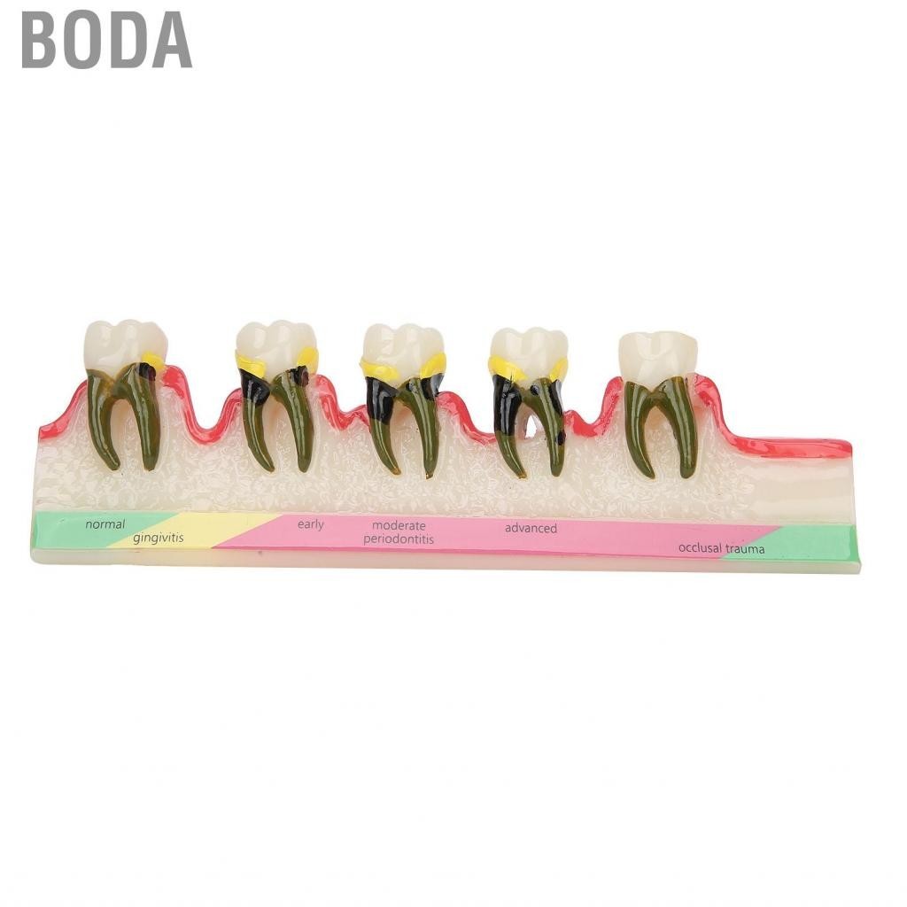 Boda การสอนการศึกษาโรคปริทันต์ทางทันตกรรมสำหรับ Den EJJ | Shopee Thailand