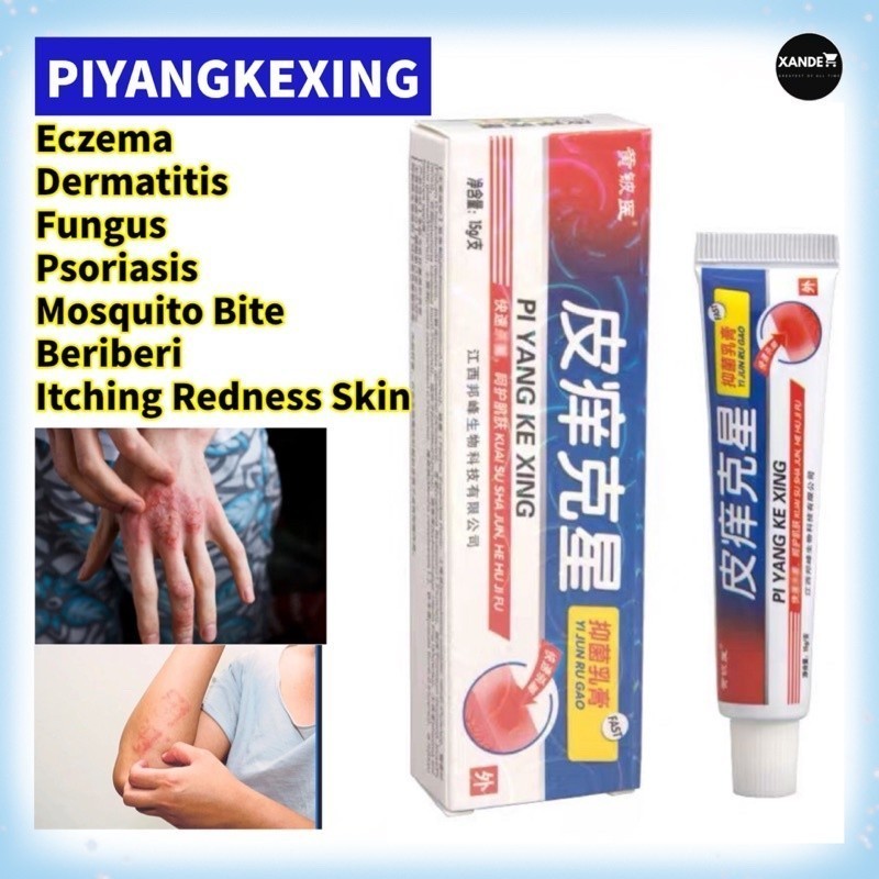 Eczema Fungal Antiptic กลากโรคสะเก็ดเงินคันครีมทาผิว 15g Krim Ubat ...