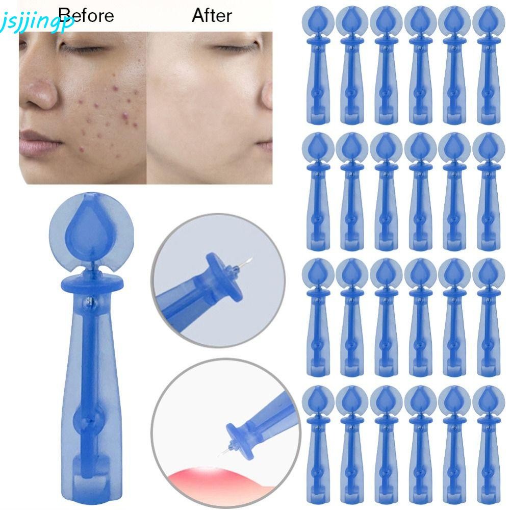 Jsjjingp 50 ชิ้น/กล่องทิ้งเข็มสิว, Pimple Pins Blackhead Remover ...