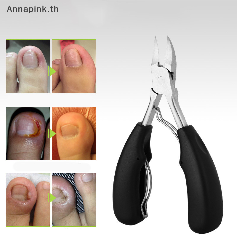 Annapink.th Toe Nail Clippers ลบ Dead Skin Nail Correction Nippers ...