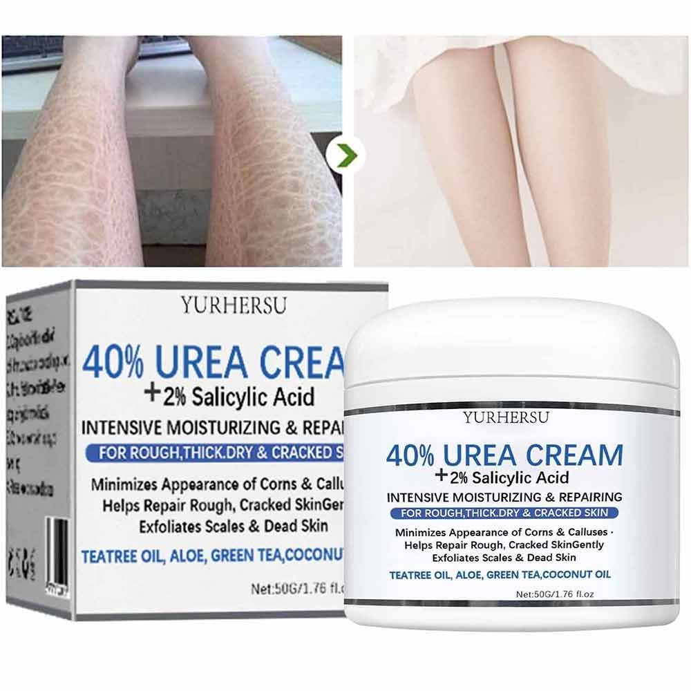 Urea Cream 40% Plus Salicylic Acid 50ml, Callus Remover Hand Cream Foot ...