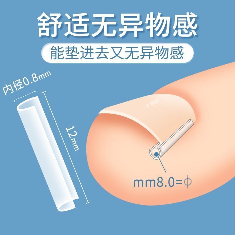 Hot Sale#Toenail Corrector Ingrown Toenail Treatment Tool Nail ...