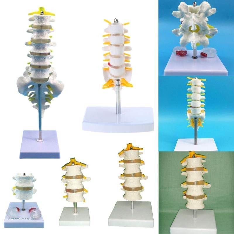 seve* Human Spine Model Lumbar Model Human Cervical Spine Model Life ...