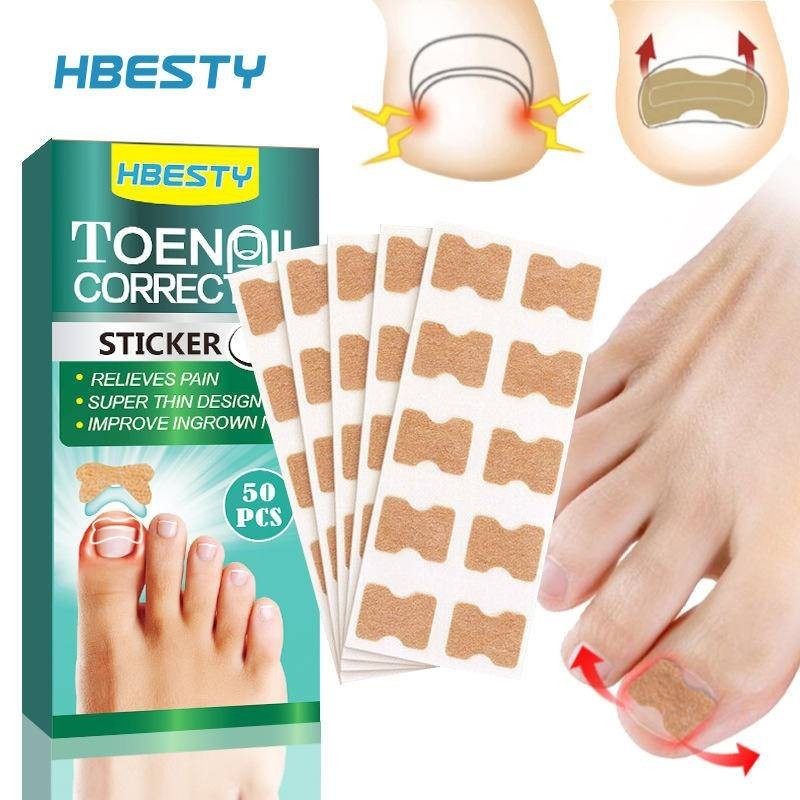 Hbesty 50 ชิ้น/กล่อง Toenail Corrector Pedicure Patch คุด Toe Nail ... Hbesty 50 ชิ้น/กล่อง Toenail Corrector Pedicure Patch คุด Toe Nail ...