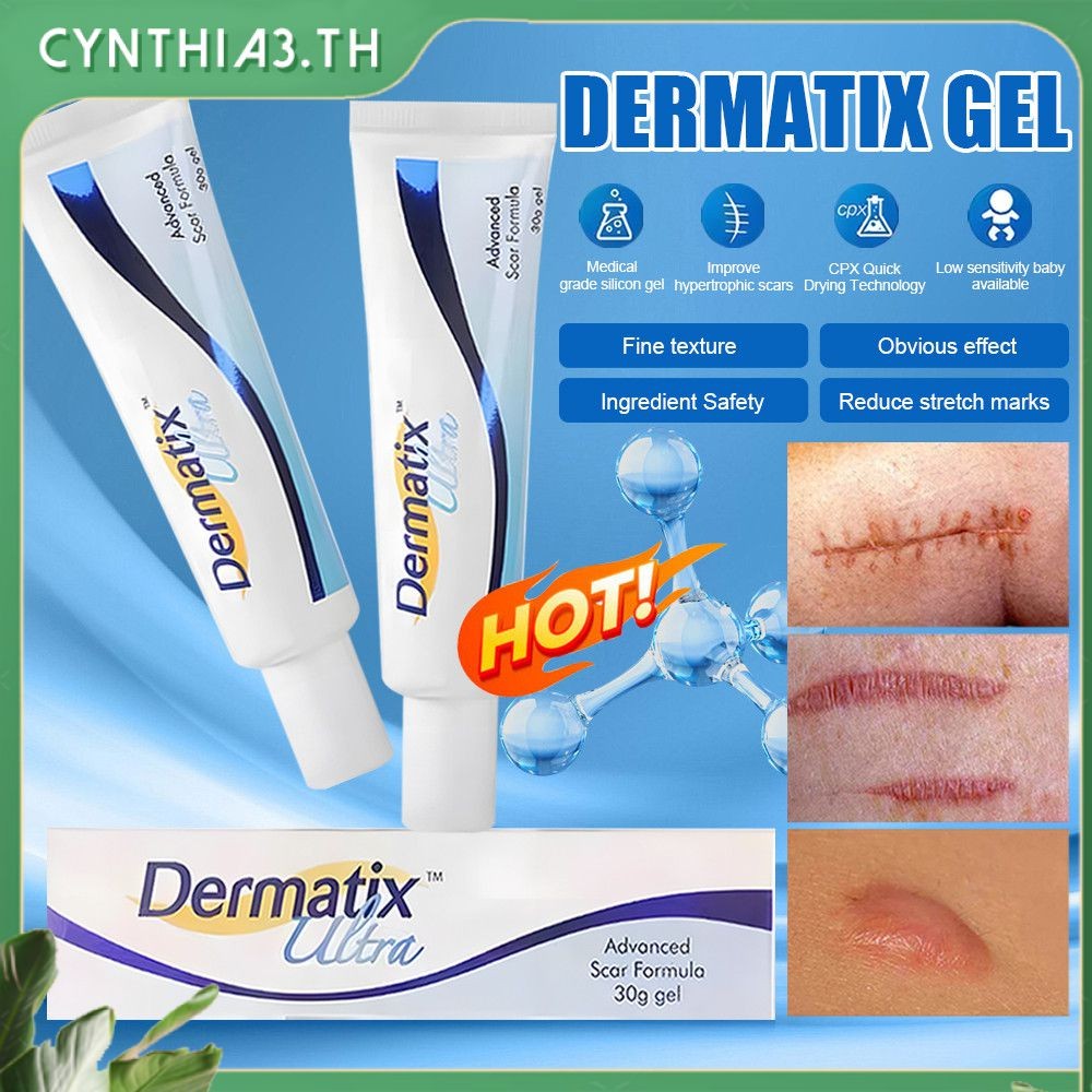 Dermatix Ultra Original Acne Scar Gel ครีมลดรอยแผลเป็น Dermatic Scar ...