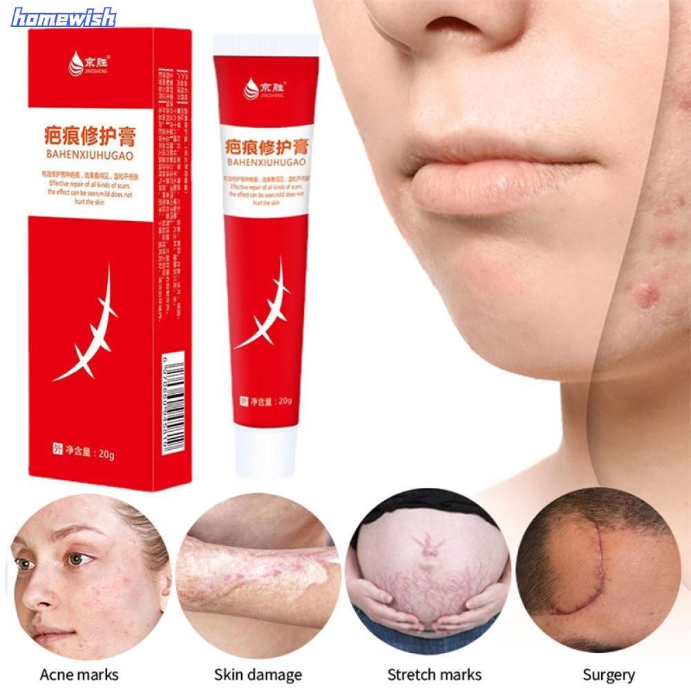 homewish-scar-repair-cream-acne-remove-gel-acne-pits-acne-scars-spots