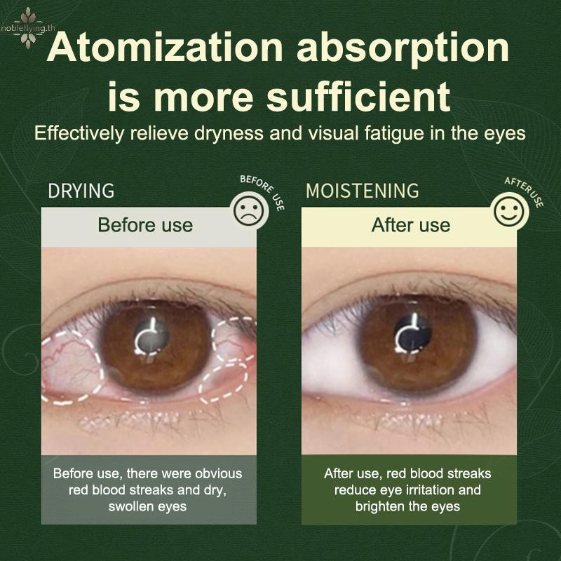 Nf Eye Moistener Nano แว่นตาแห้งและ Astringent เพื่อบรรเทาความเมื่อยล้า ...