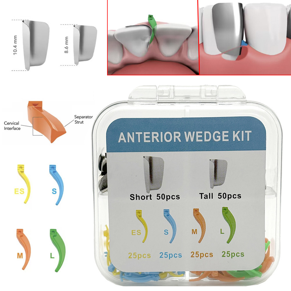 200 ชิ้น/เซ็ตทันตกรรม Anterior Matrix System Wedge Matrix Bands ...