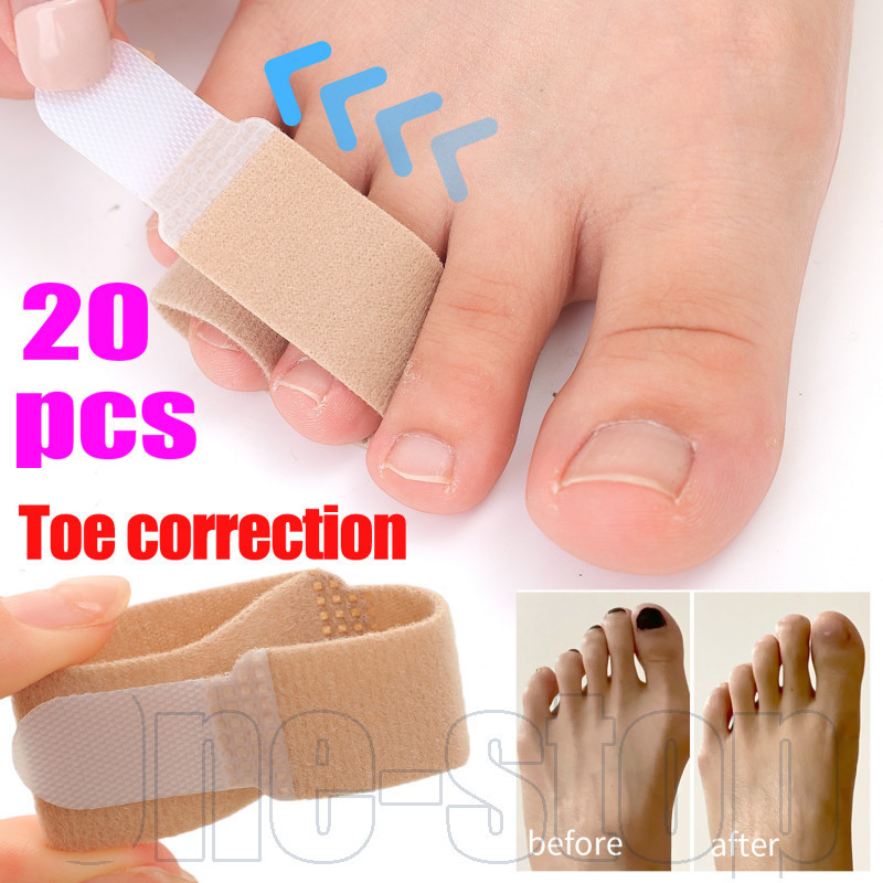 เครื่องหนีบผมนิ้วเท้าแบบปรับได้ 20 ชิ้น | Hammer/Overlap Toe Splints ...
