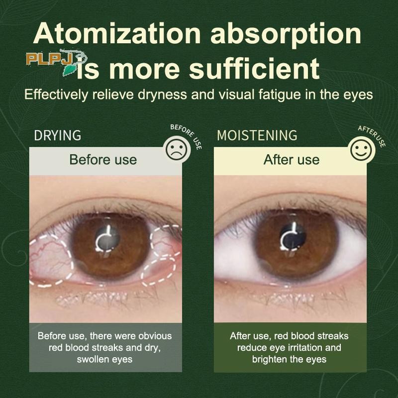 PLPJ Eye Moistener Nano แว่นตาแห้งและ Astringent เพื่อบรรเทาความเมื่อย ...