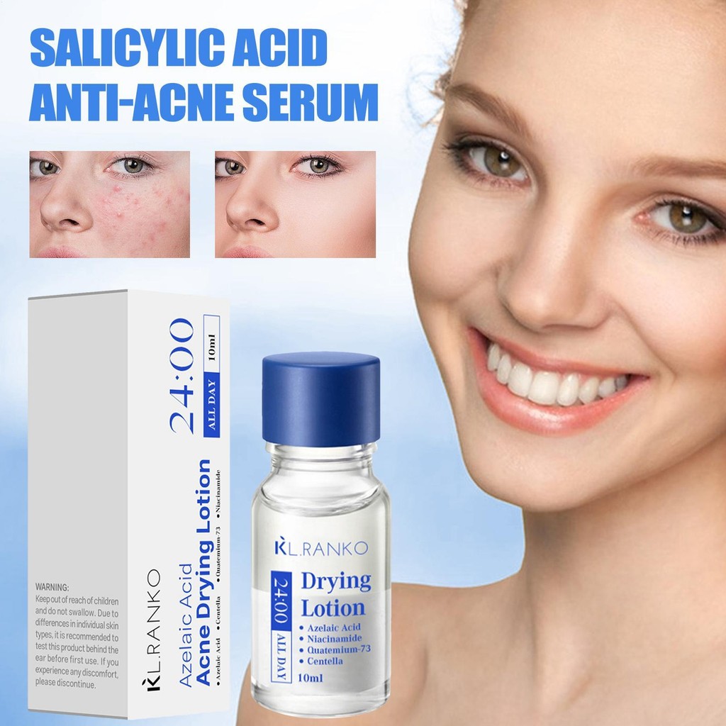 Salicylic Acid Anti-Acne Serum Pimple Drying Lotion Fast-Acting Facial ...