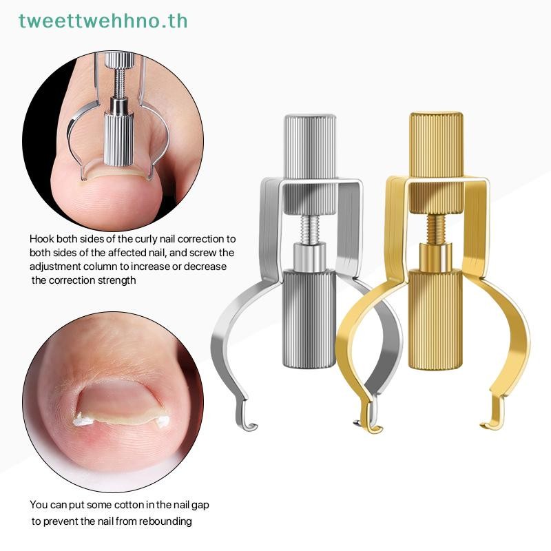 Tweettwehno คุด Toenail Corrector คุด Toenail Lifter คุด Toenail ...