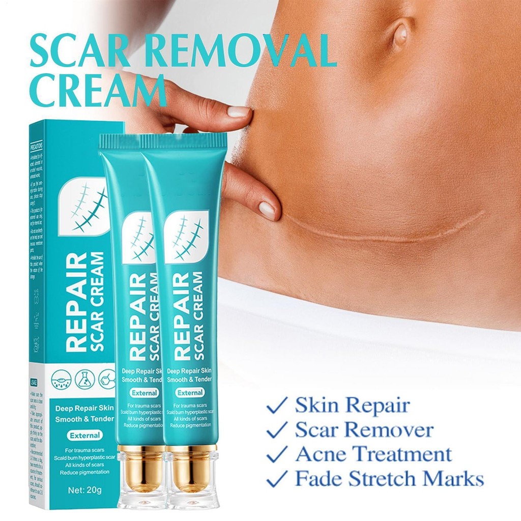 Professional Scar Removal Cream 20g Fast Removal Skin Scars Cream ...