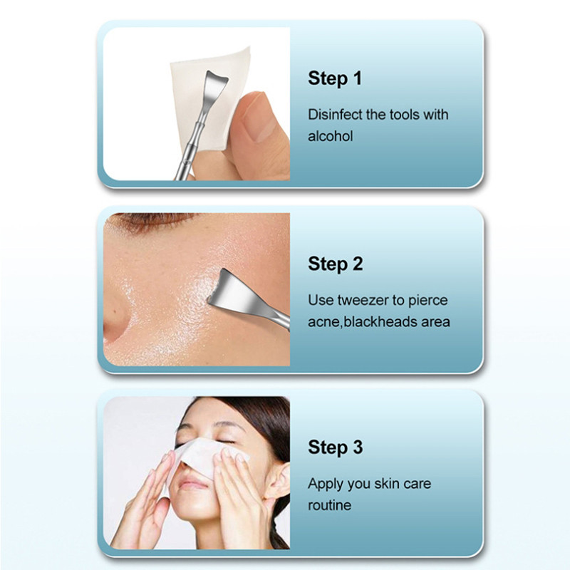 [DJNZ] 2 In 1 Pimple Popper Tool Blackhead Remover Acne Removing ...