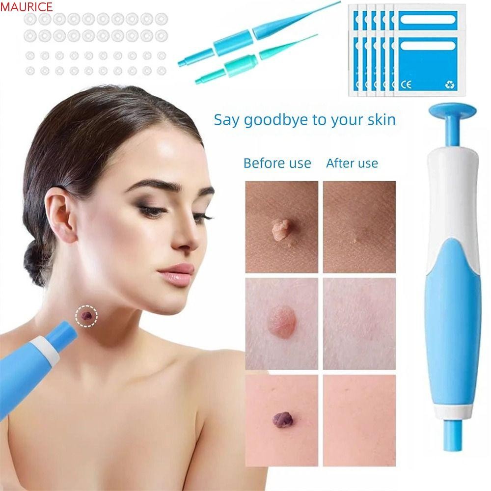 Maurice Auto Micro Skin Tag Remover อุปกรณ์, 2 in 1 สุขภาพ Mole Stain ...