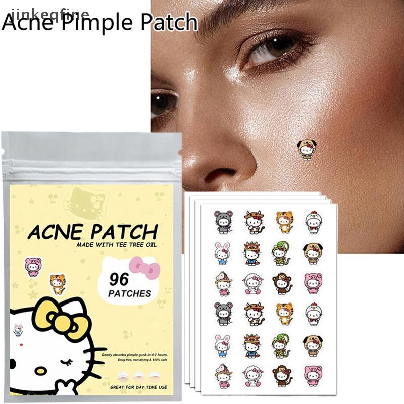 KTH 96 ชิ้น Hello Kitty Cat Repair Acne Patch Facial Skin Care Fade ...