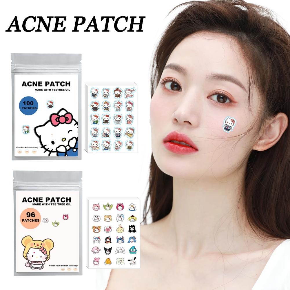 น่ารัก Hello Kitty Acne Patch สติ๊กเกอร์ดูแลผิวแมวการ์ตูน Pe Acne Stickers | Shopee Thailand
