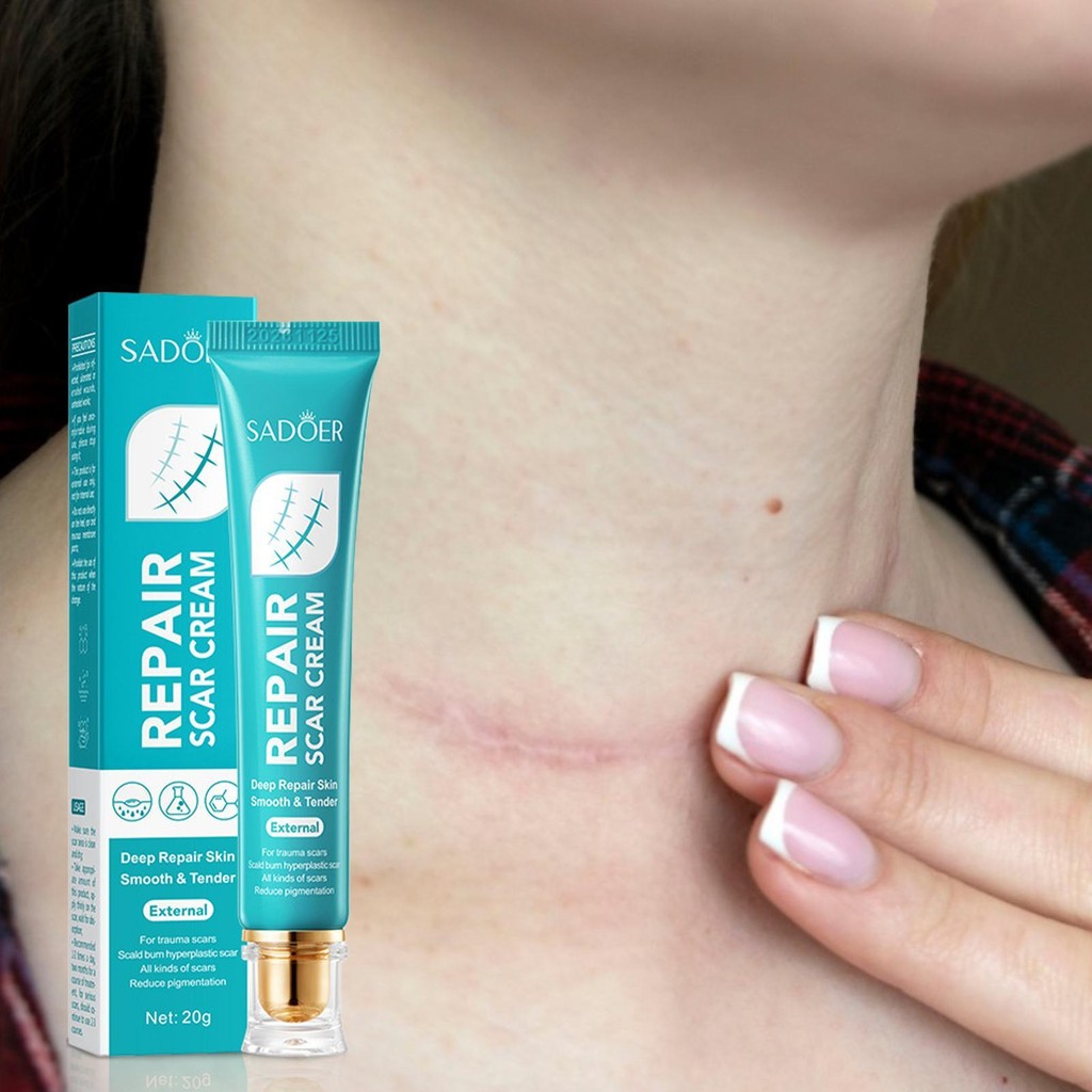 Professional Scar Removal Cream 20g Fast Removal Skin Scars ครีมยืด ...
