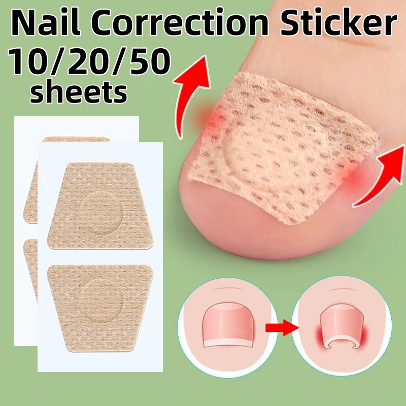 10/20/50Sheepts คุด Toenail Corrective สติกเกอร์ Foot Care Recovery ...