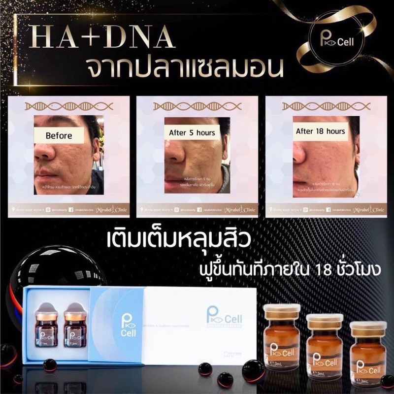 PCell PDRN หน้าใส ฉ่ำวาว รูขุมขนกระชับ 1 ขวด 3 ml | Shopee Thailand