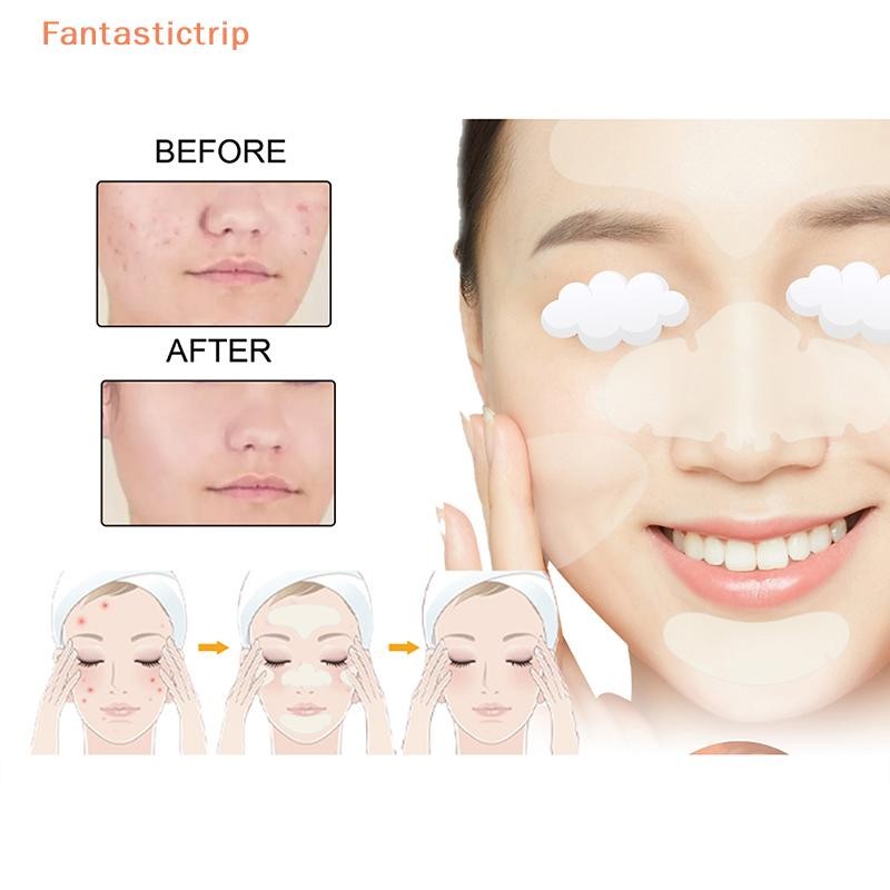Fantastictrip Repair Acne Patch Facial Skin Care Fade Blemishes Pimple ...