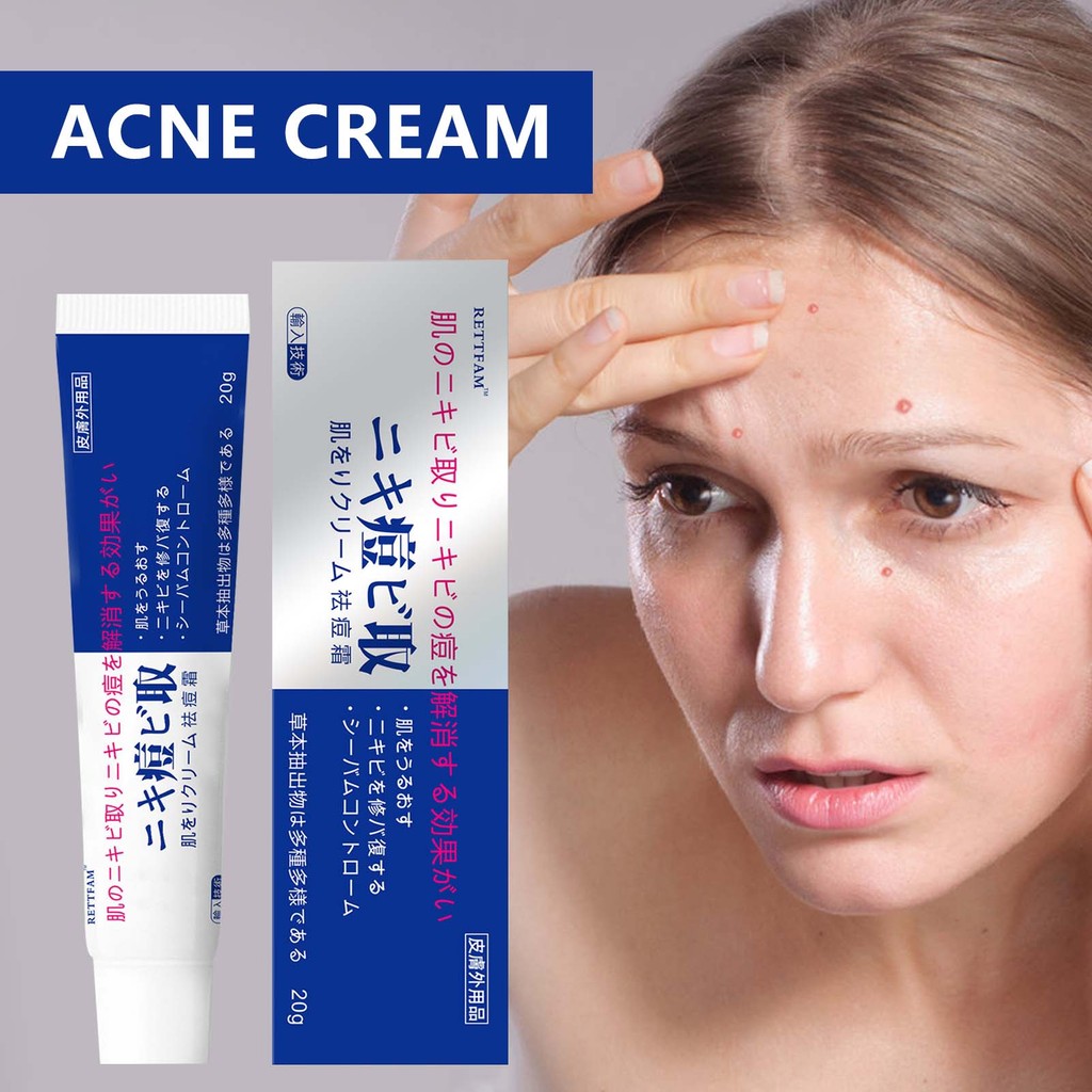 Japan Acne Treatmen Pimples Removal Cream 20g ครีมบํารุงผิวหน้ากําจัด ...