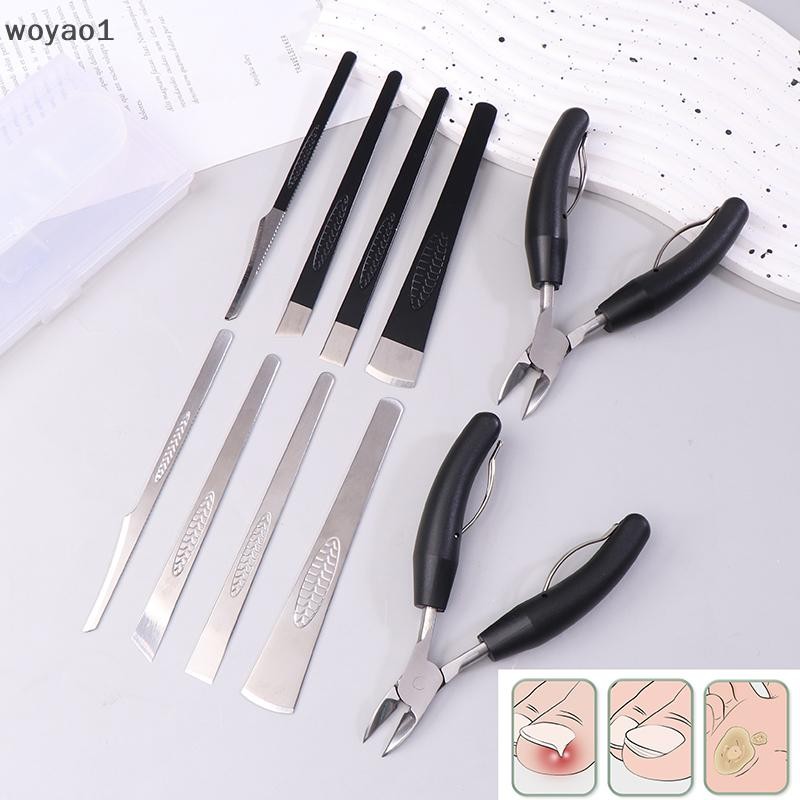[woyao1] 5 ชิ้น/เซ็ตเล็บเครื่องมือ Toe Nail Scraper ฟุต Pedicure Kit ...