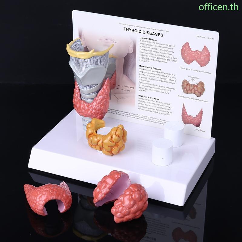 Cen Human Anatomical Thyroid Gland Model พยาธิวิทยา Anatomy Digestive ...