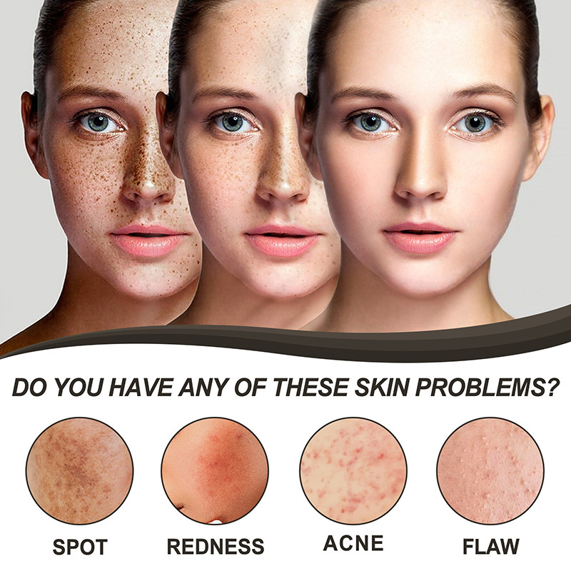 IFA West&Month Spot Patch Fade Spot Red Spot Acne Mark ปิดฝ้า Cover ...