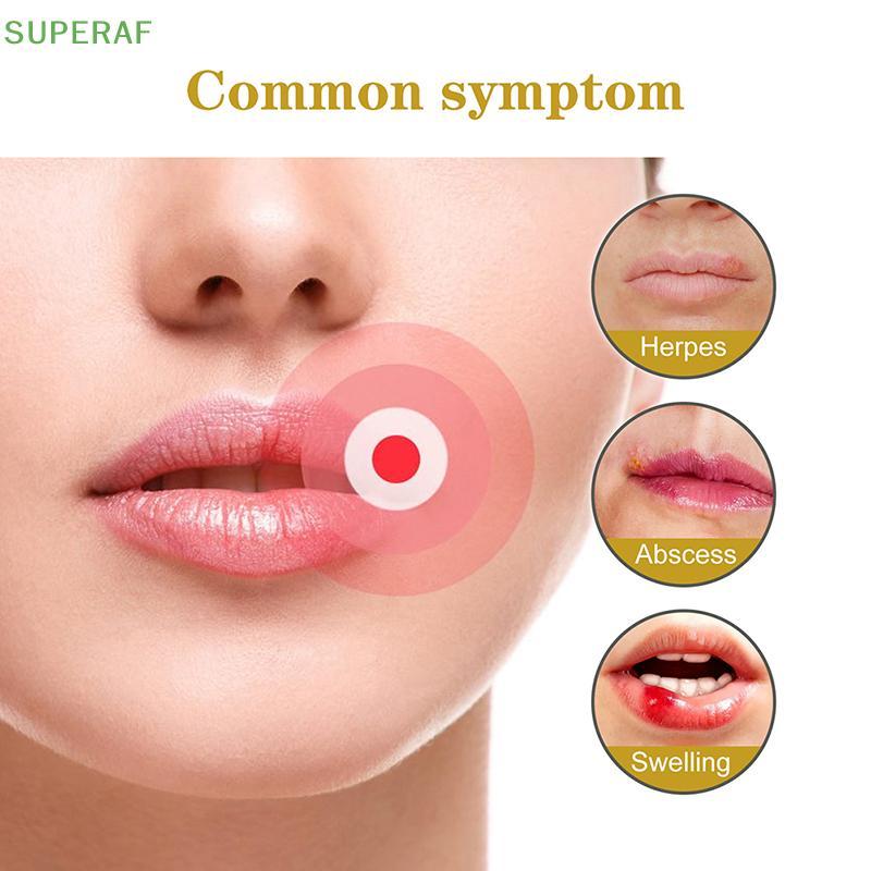 SUPERAF 60 ชิ้นเย็น Sore Lip Patch Cheilitis Treatment Lip Pain Relief ...