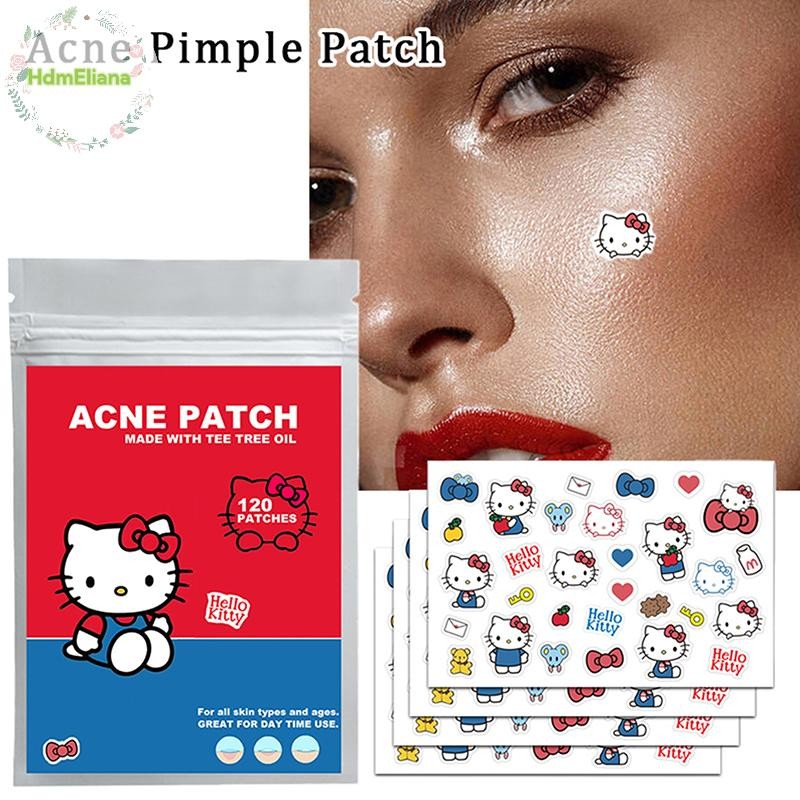 HdmEliana 120 ชิ้น Hello Kitty Cat Repair Acne Patch Facial Skin Care ...