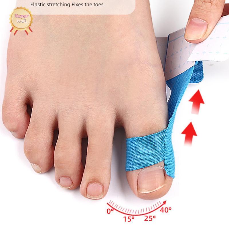 SuperNail 5 แผ่นผ้ายืดหยุ่น Toe Separator Patch Bunion Hallux Valgus Corrector Thumb Correction ...