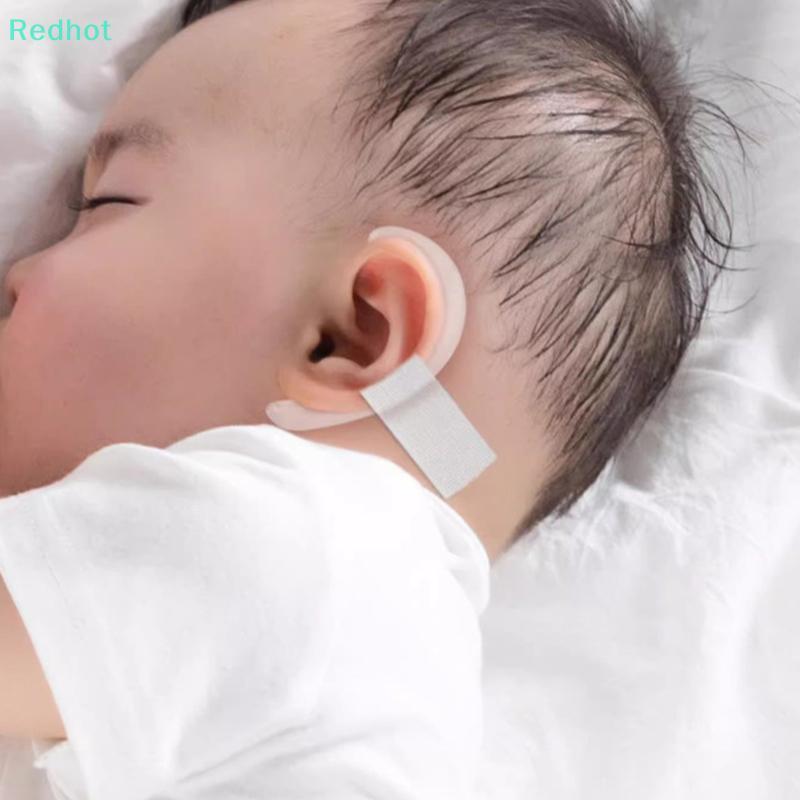 Protruding Ear Support Infant Corrector Tools Silicone Auricle ...