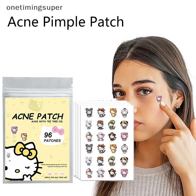 Onetimingsuper 96 ชิ้น Hello Kitty Cat Repair Acne Patch Facial Skin ...