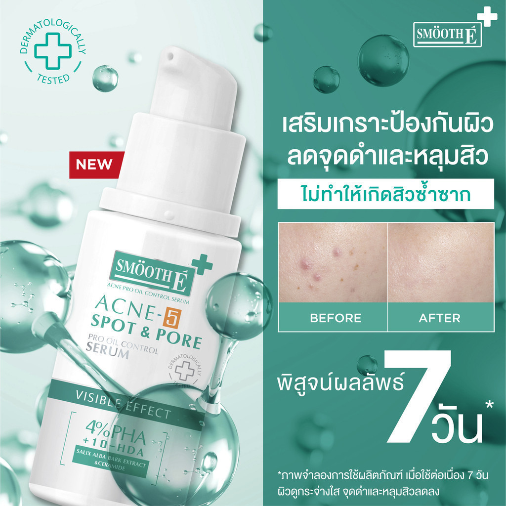 [ซื้อ 1 ฟรี 2] Smooth E Acne Pro Oil Control Serum free Acne & SCA ...