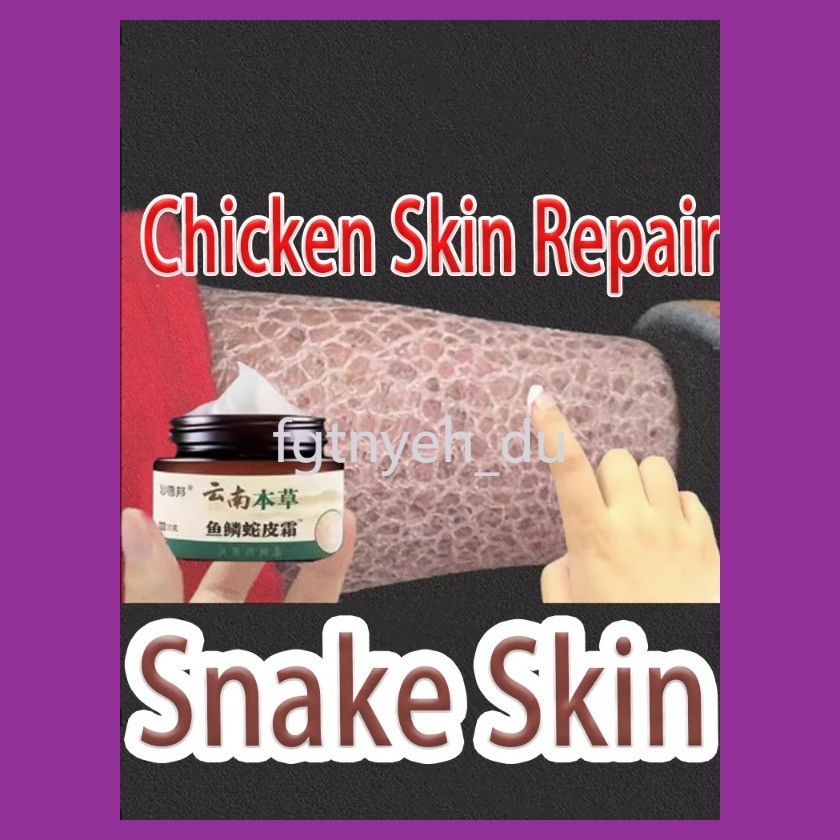 Chicken Skin Repair Cream Curing Keratosis Follicle Pilaris Body Dark ...