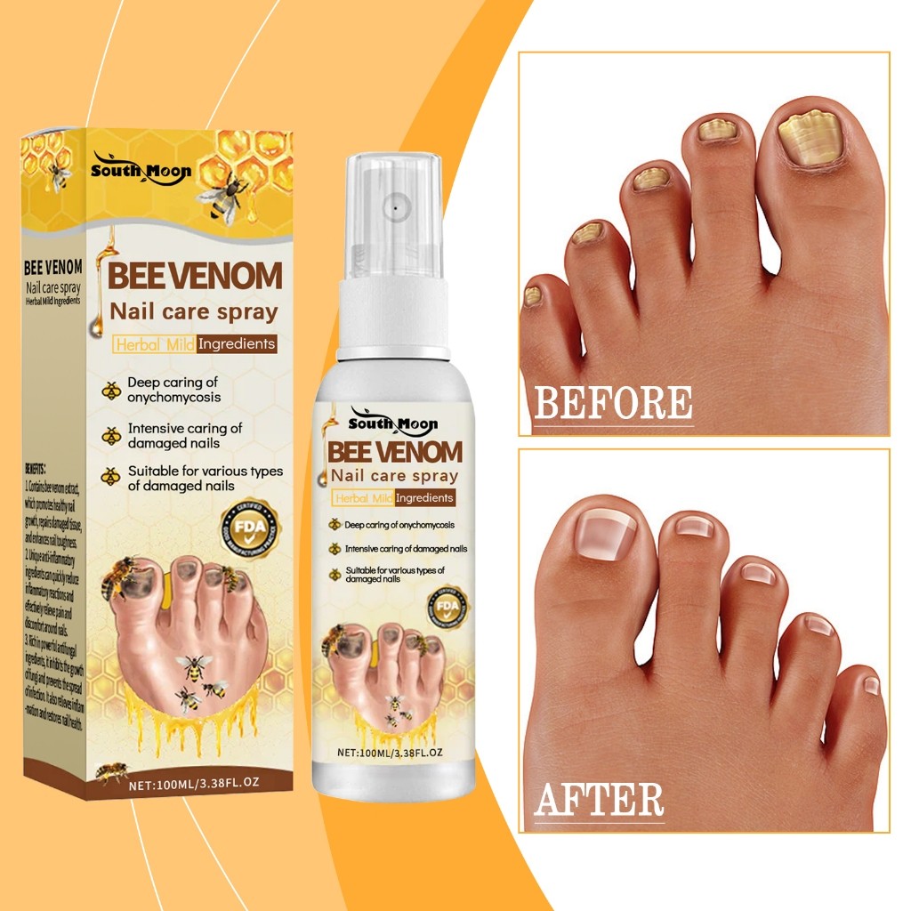 ในสต็อก Bee Venom Anti Fungal Nail Spray Paronychia Treatment หนา ...