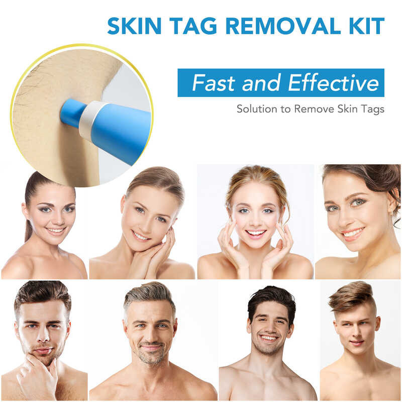 ใน 1 2 ชุดอัตโนมัติ Micro Skin Tag อุปกรณ์กำจัด Nevus Vest Remover ...