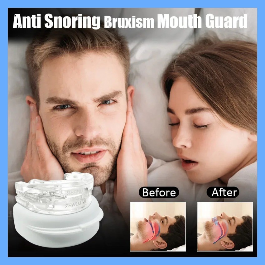 tk Anti Snoring Bruxism Mouth Guard Improve Sleeping Teeth Bruxism ...