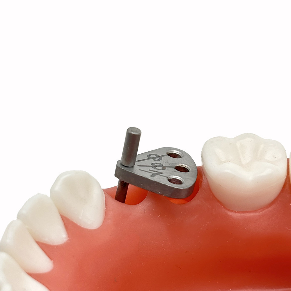 ทันตกรรม Implant Parallel Pin Gauge สแตนเลส Locator ทันตกรรม Implant ...