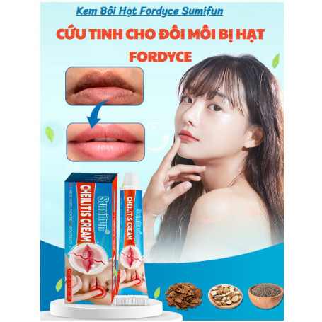 Fordyce Seed Acne Lip Balm, Sebum, herpes, ให้ความชุ่มชื้นริมฝีปาก ...