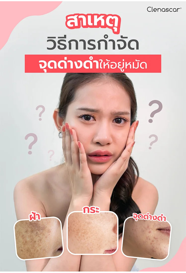 Hundred Bunch Blemish Blemish Cream Refreshing Moisturizing Non-Sticky ...