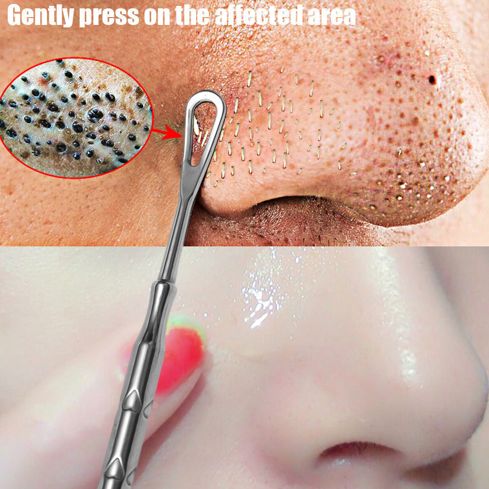 Professional Blackhead Remover Flat Pusher - Double Head Stainless ...