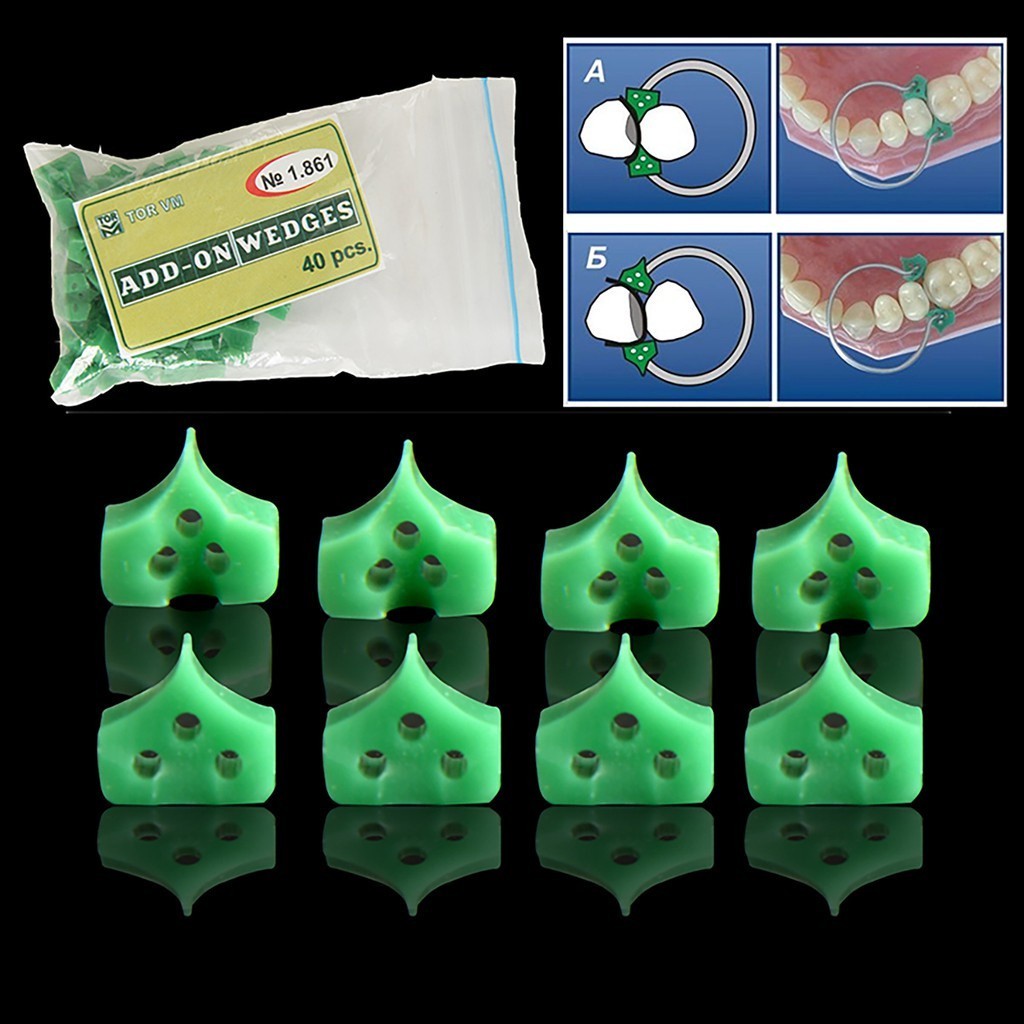 40pcs ทันตกรรม Matrix Sectional Contoured โลหะ Matrices Wedges ซิลิโคน ...