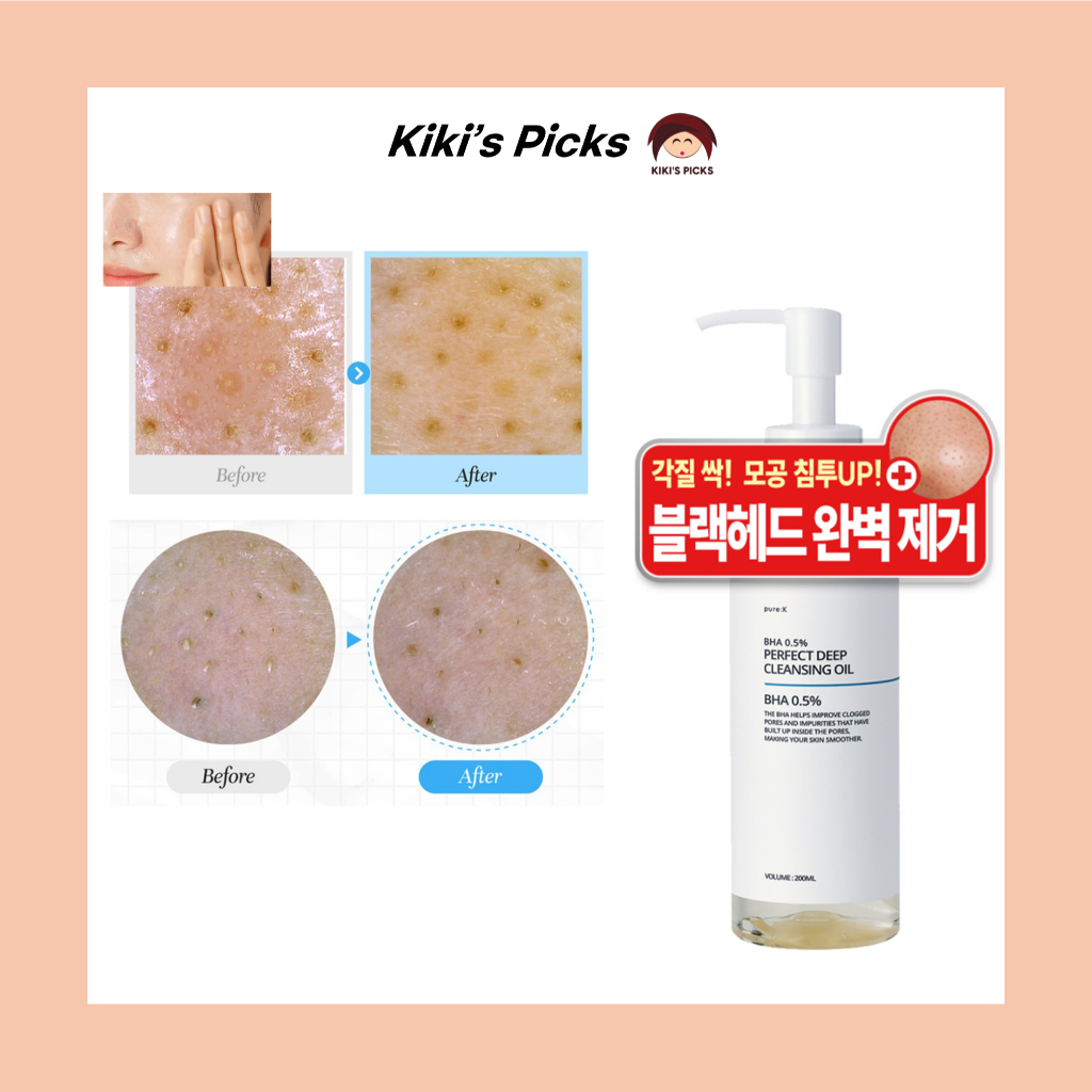Pure-k Blackhead & Sebum Remover BHA 0.5% Perfect Deep Cleansing Oil ...