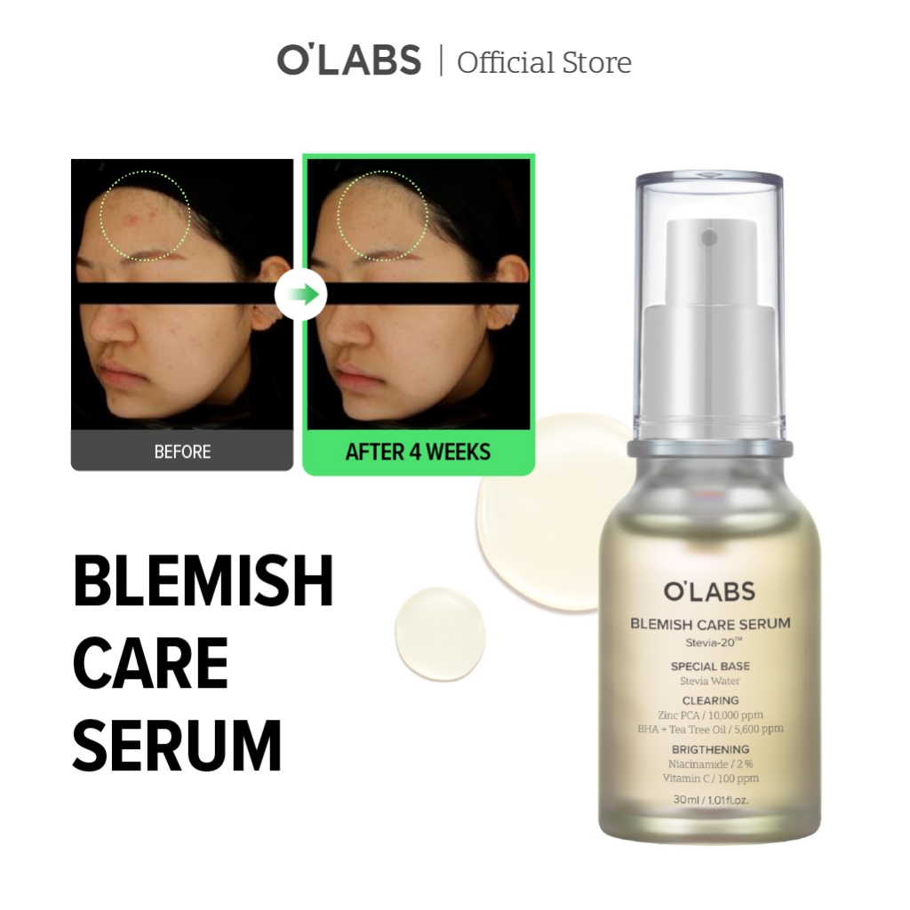 [OLABS] Blemish Care Serum 30ml Excess Sebum & Brightening Care Acne ...